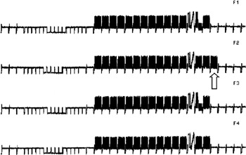 Chapter 2.7: VBI Data Carriage | GlobalSpec