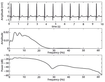3.2: Spectral and Cross-Spectral Analysis of the ECG | Engineering360