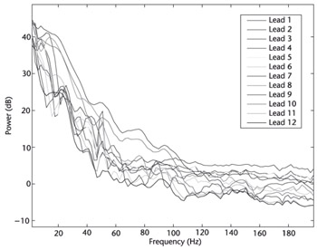 3.2: Spectral and Cross-Spectral Analysis of the ECG | GlobalSpec